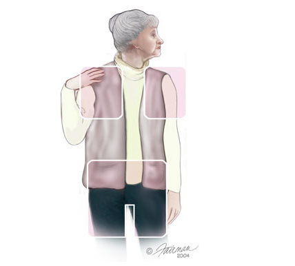 Polymyalgia Rheumatica – NHR Association